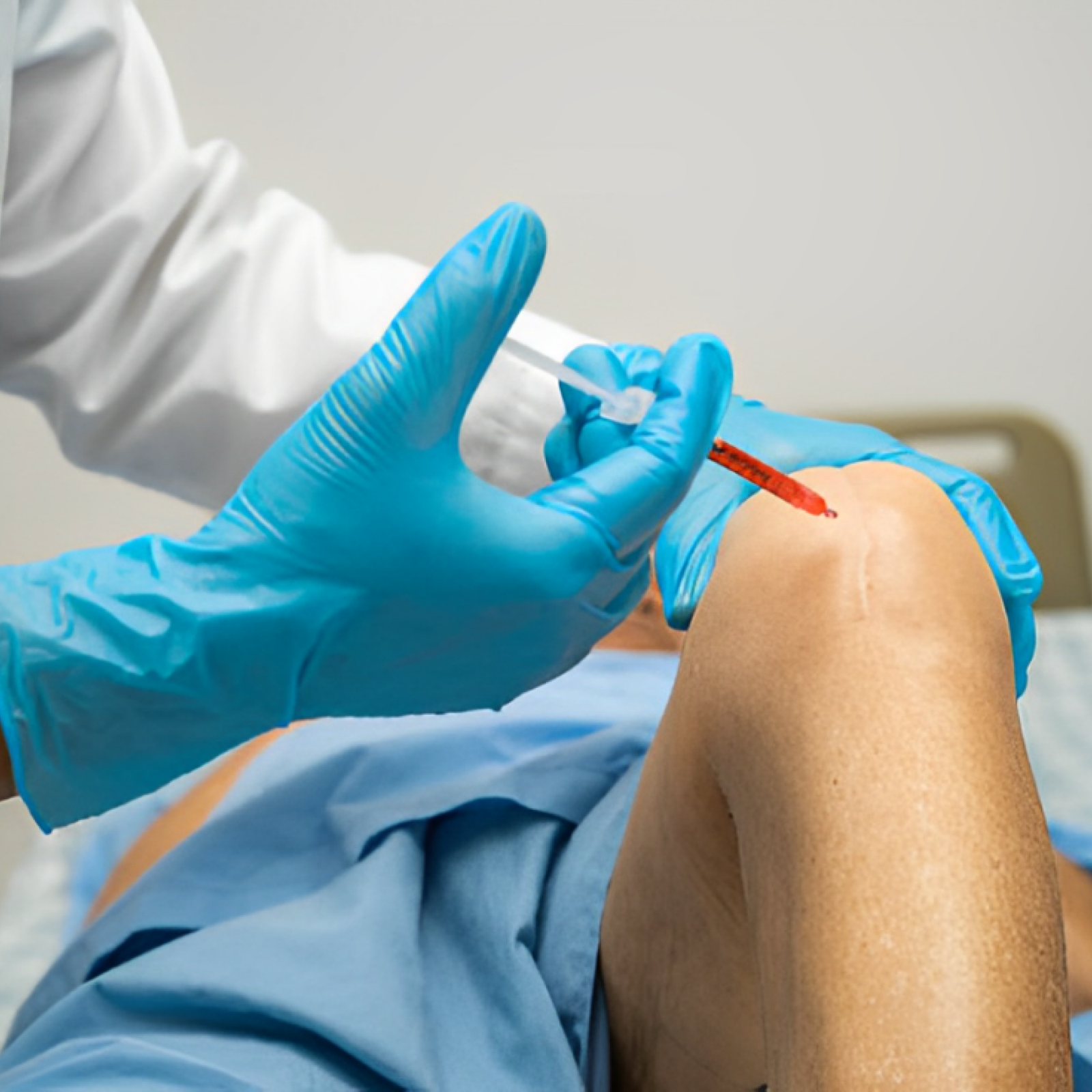 PRP Injections for Pain Relief in Hyderabad